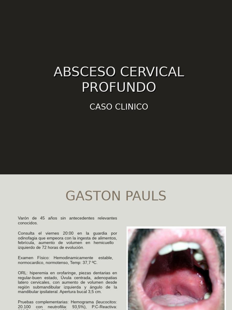Absceso de Cuello Caso Clinico Resis | PDF