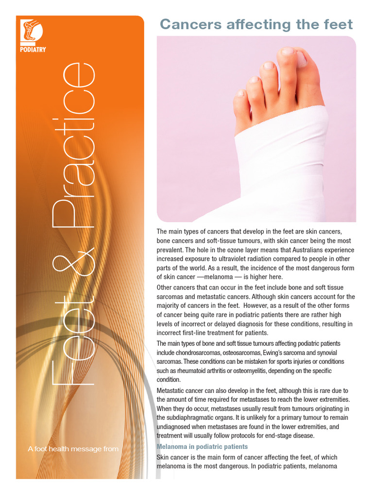 Foot Cancer Types and Treatments | PDF | Melanoma | Cancer