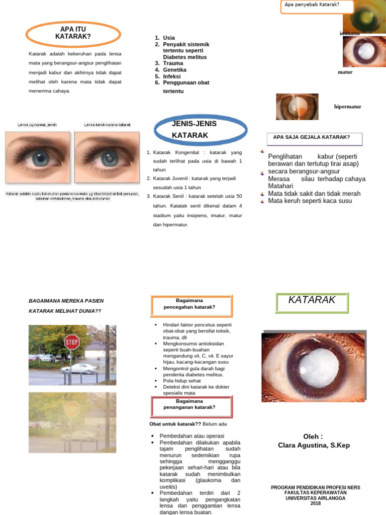 Leaflet Penyuluhan Mandiri Katarak | PDF