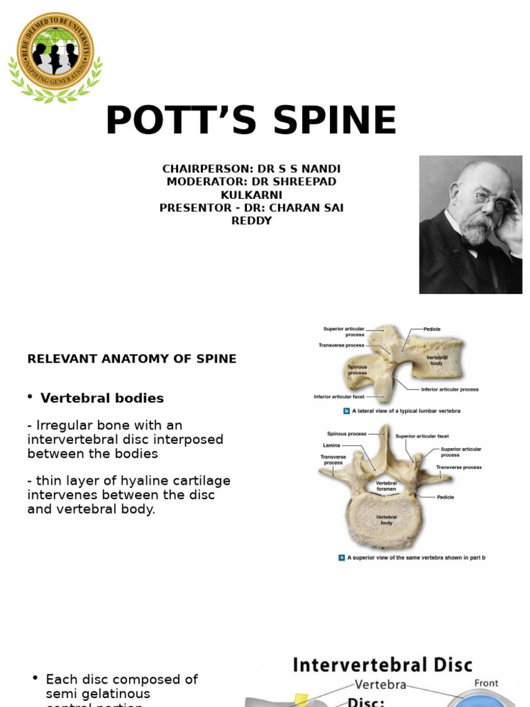 Potts Spine | PDF