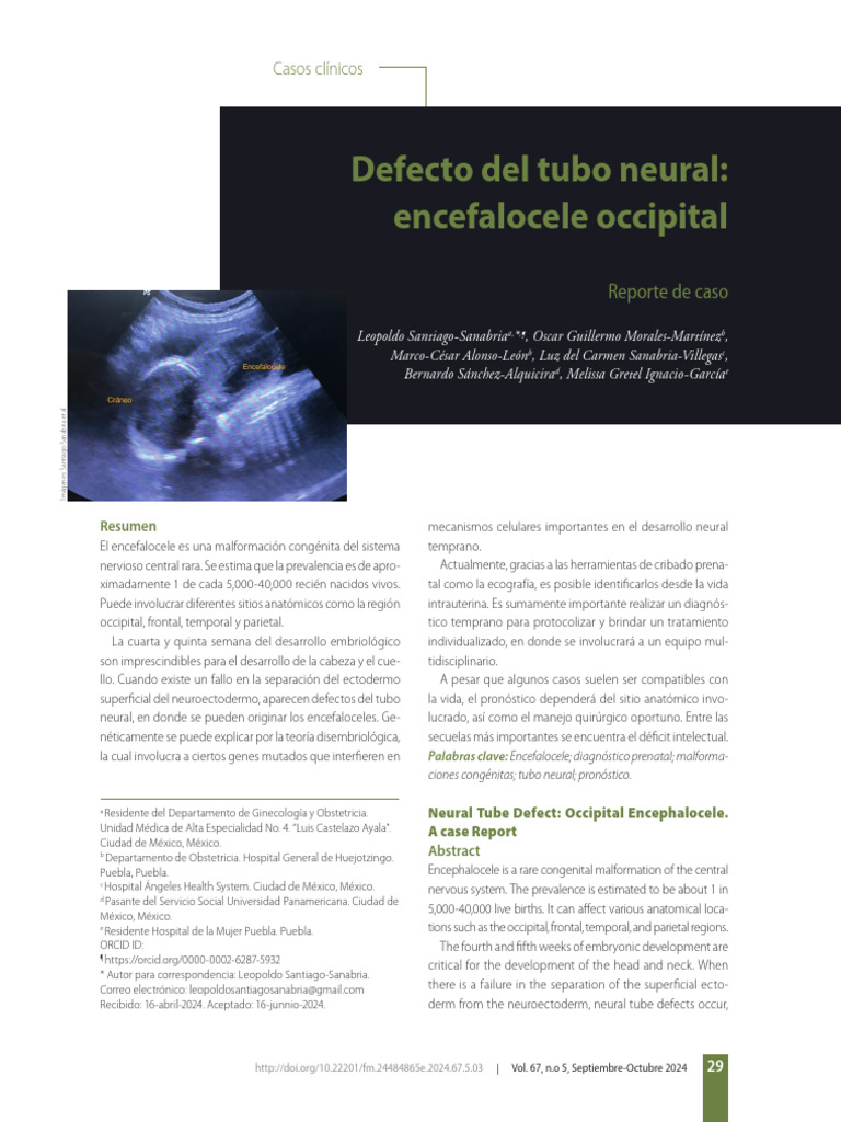 04 - Defecto Del Tubo Neural - Encefalocele Occipital2 | PDF