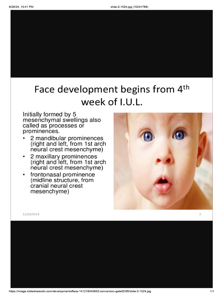 Dev of Face Seminar | PDF