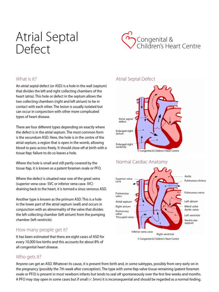 Atrial Septal Defect | Atrium (Heart) | Thorax (Human Anatomy)