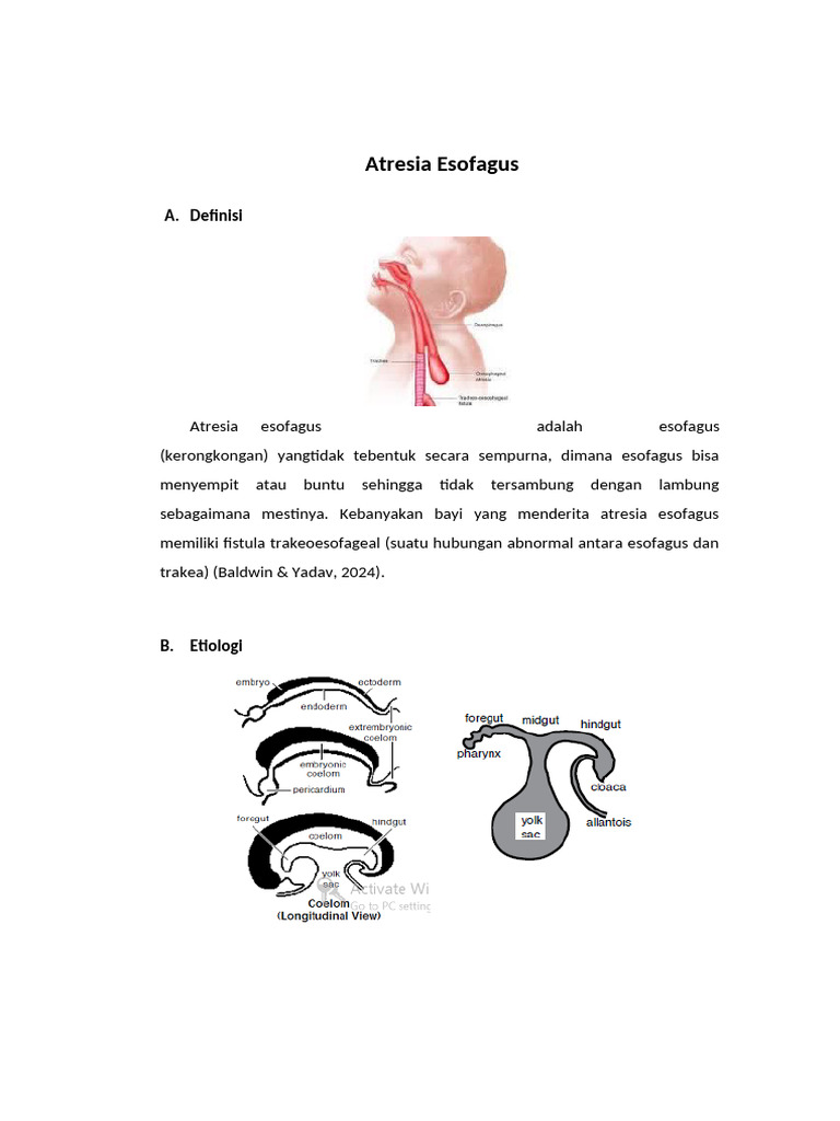 Atresia Esofagus | PDF