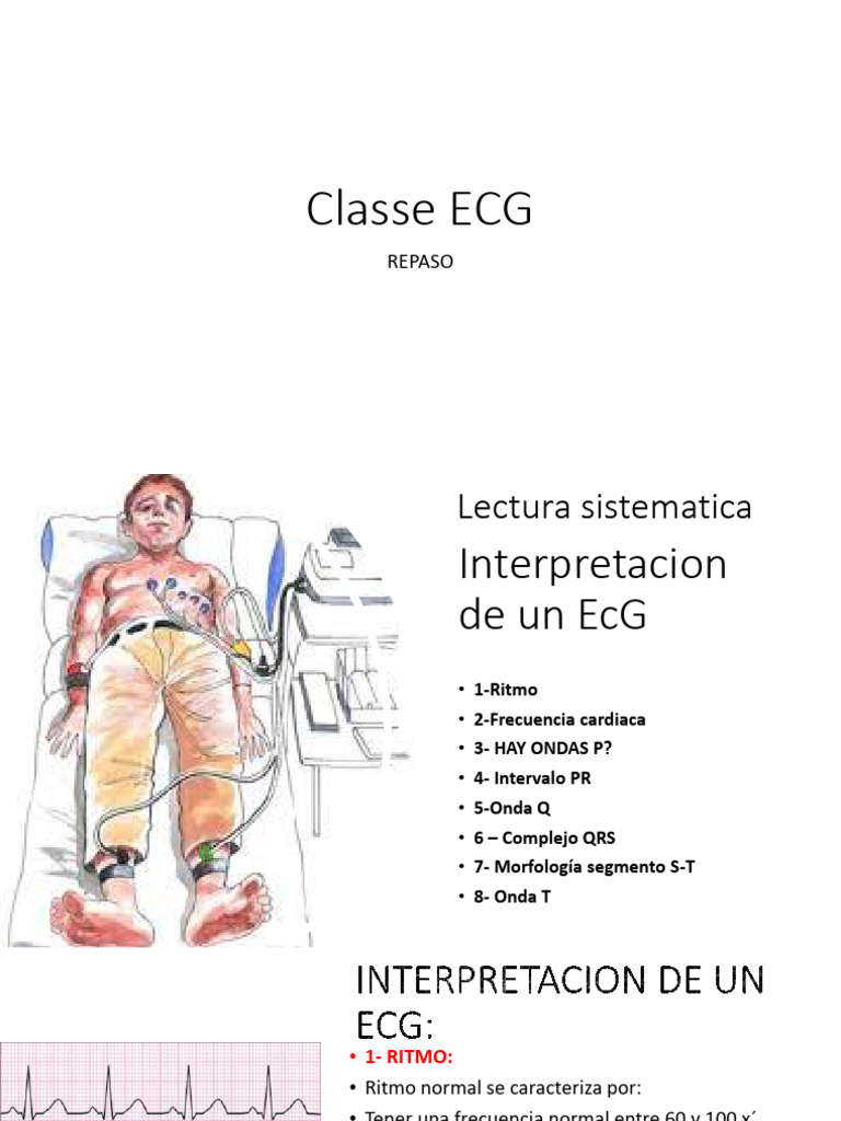 Classe ECG Dia 11 | PDF