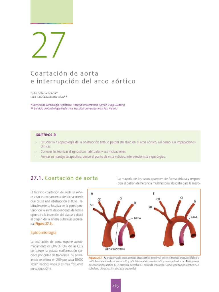 Coartacion de Aorta | PDF