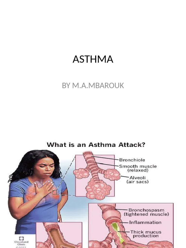 Session 12 Asthma | PDF | Asthma | Wellness