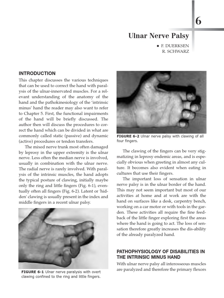Ulnar Nerve Palsy | PDF | Thumb | Hand