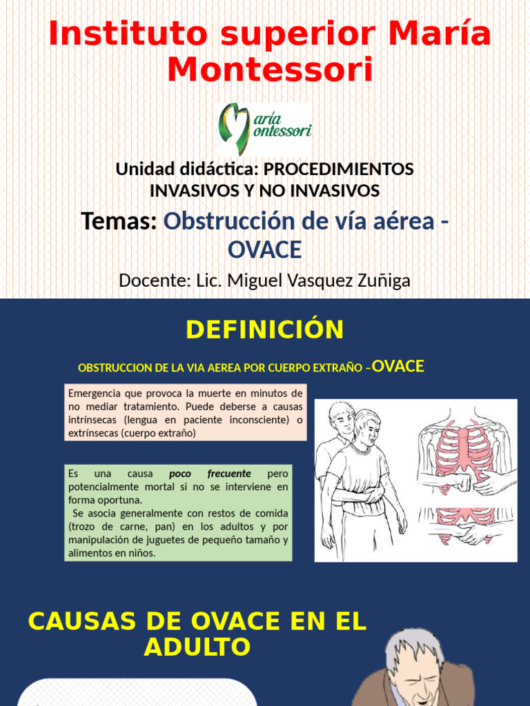 Tema 8.2 OVACE | PDF