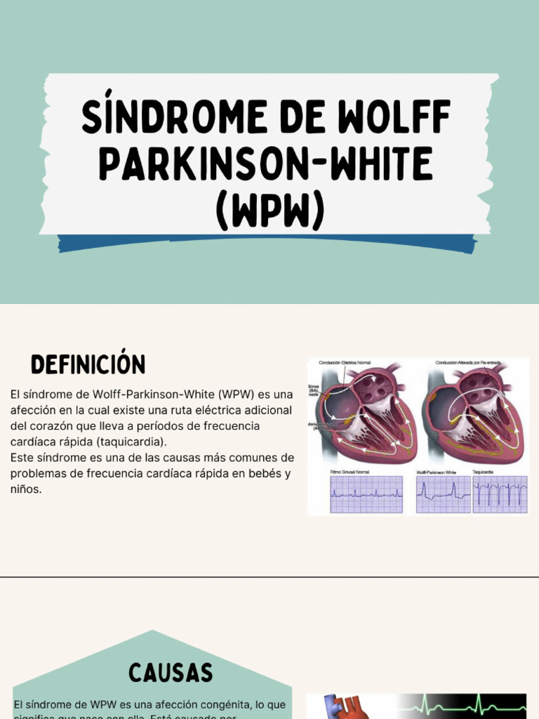 SINDROME DE WOLFF UDABOL | PDF