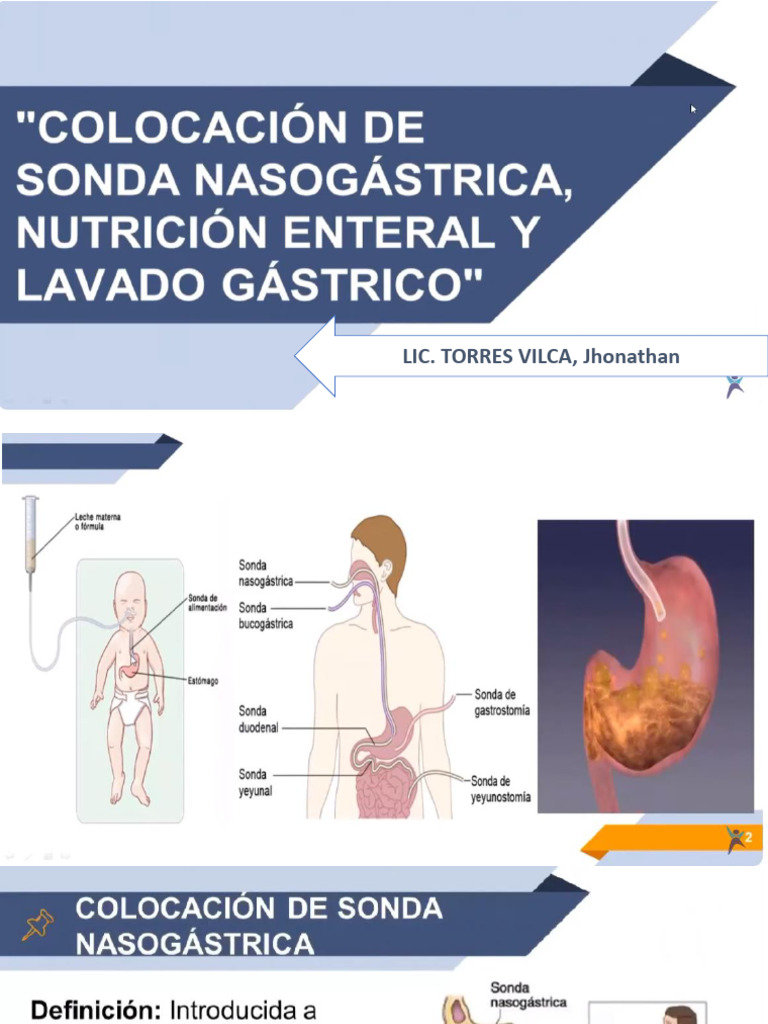 SONDA NASOGASTRICA | PDF