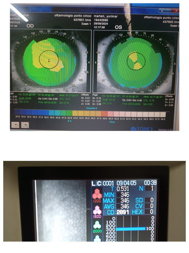 imágenes de ojos | PDF
