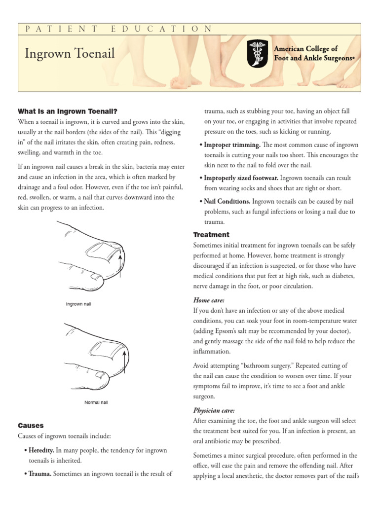 Ingrown Toenail | PDF