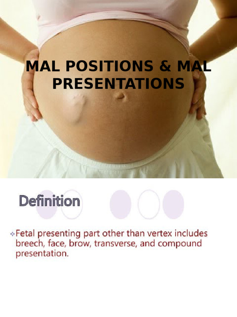 Malpositions & Mal Presentations | PDF