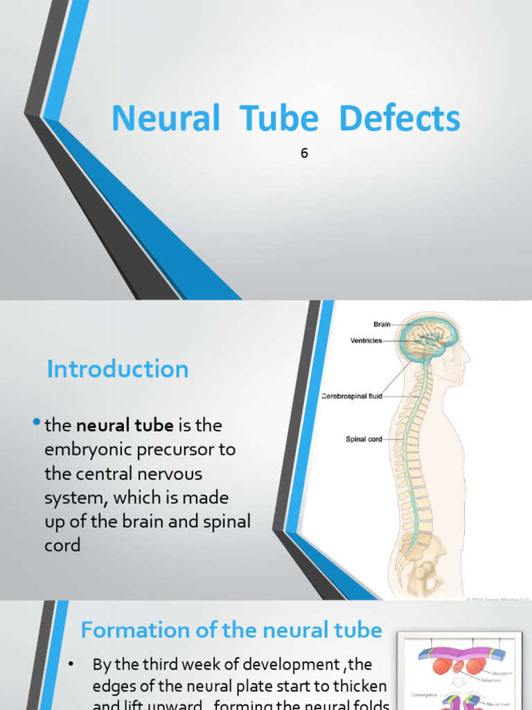 Neural Tube Defects | PDF