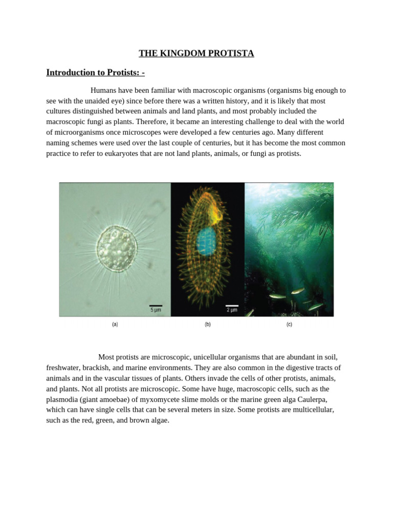 Kingdom Protista Complete Assignment | PDF