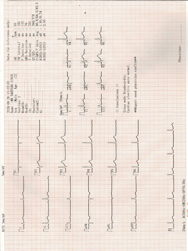 ECG | PDF