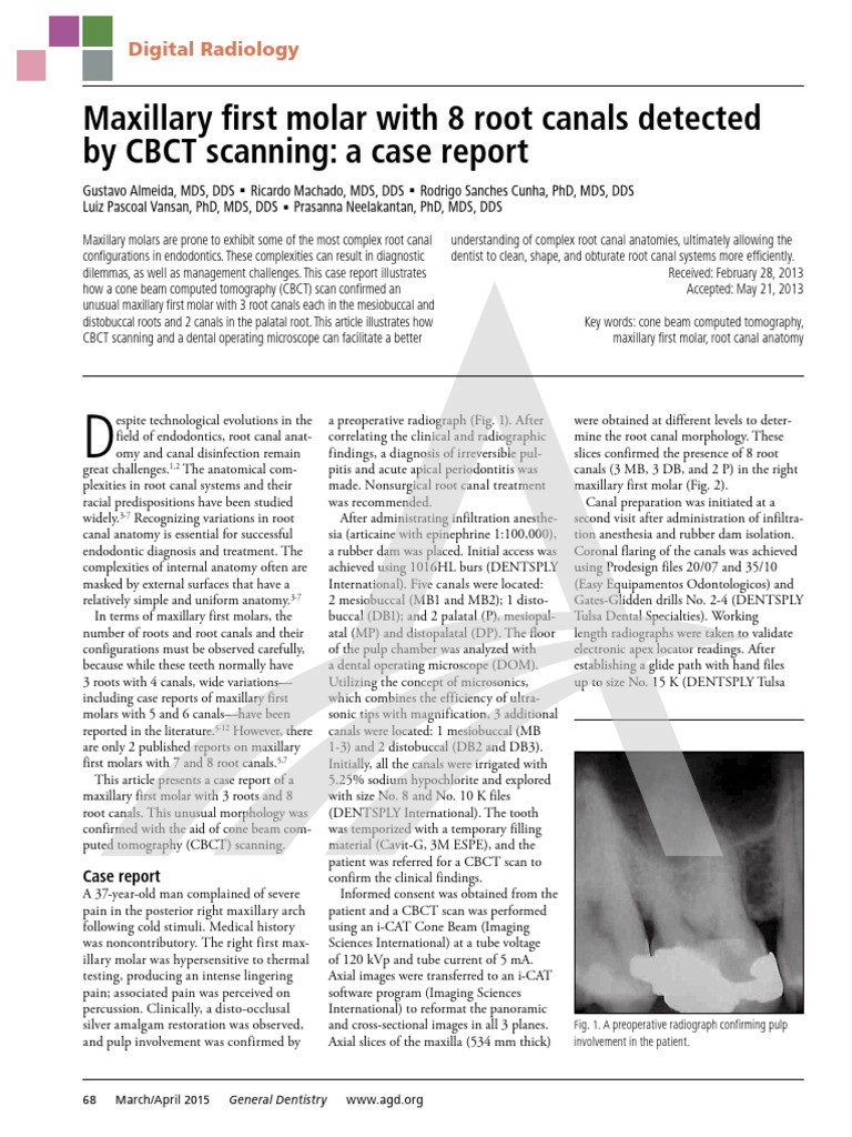 Maxillary First Molar With 8 Root Canals Detected by CBCT Scanning: A ...