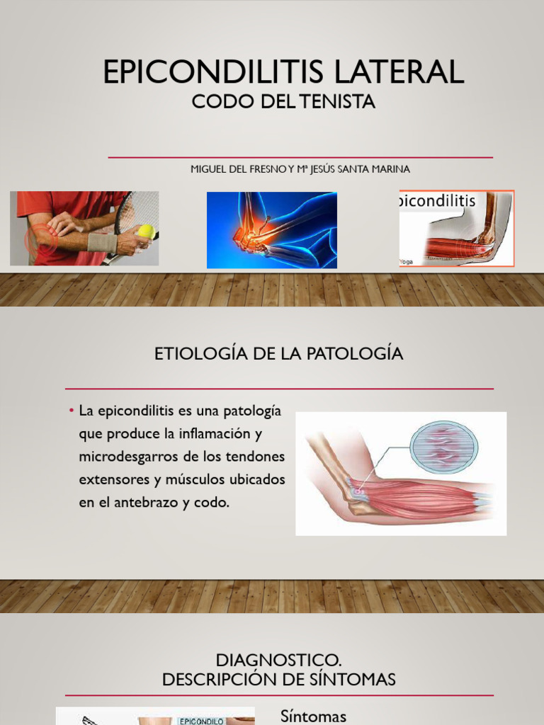 Epicondilitis Lateral | PDF