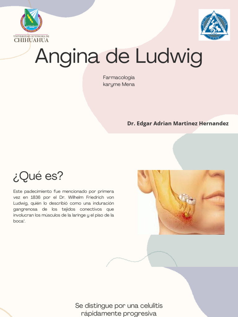 Angina de Ludwig | PDF