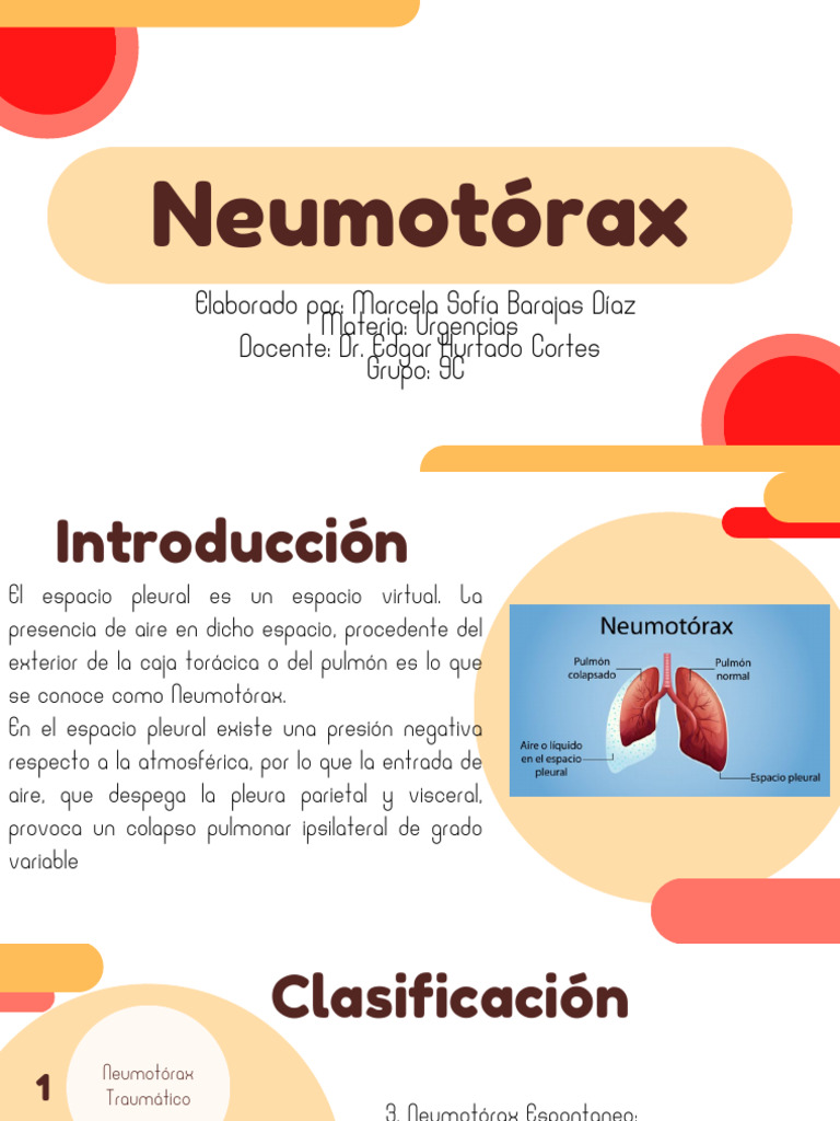Neumotórax Corregida | PDF