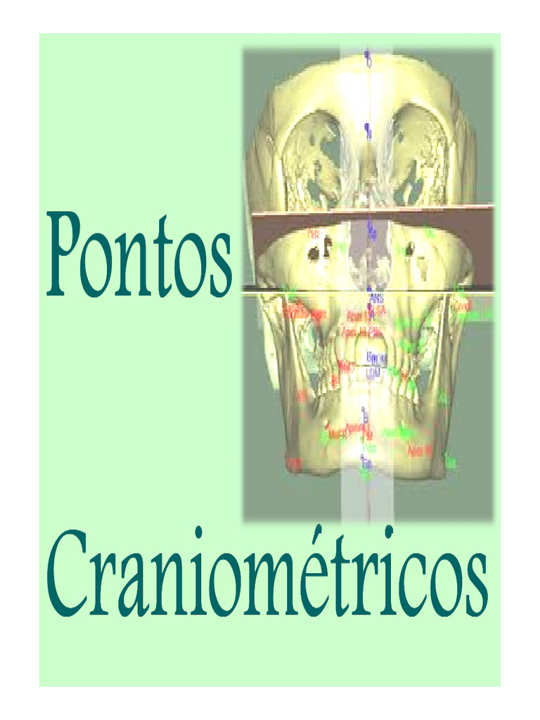 Pontos craniométricos | PDF