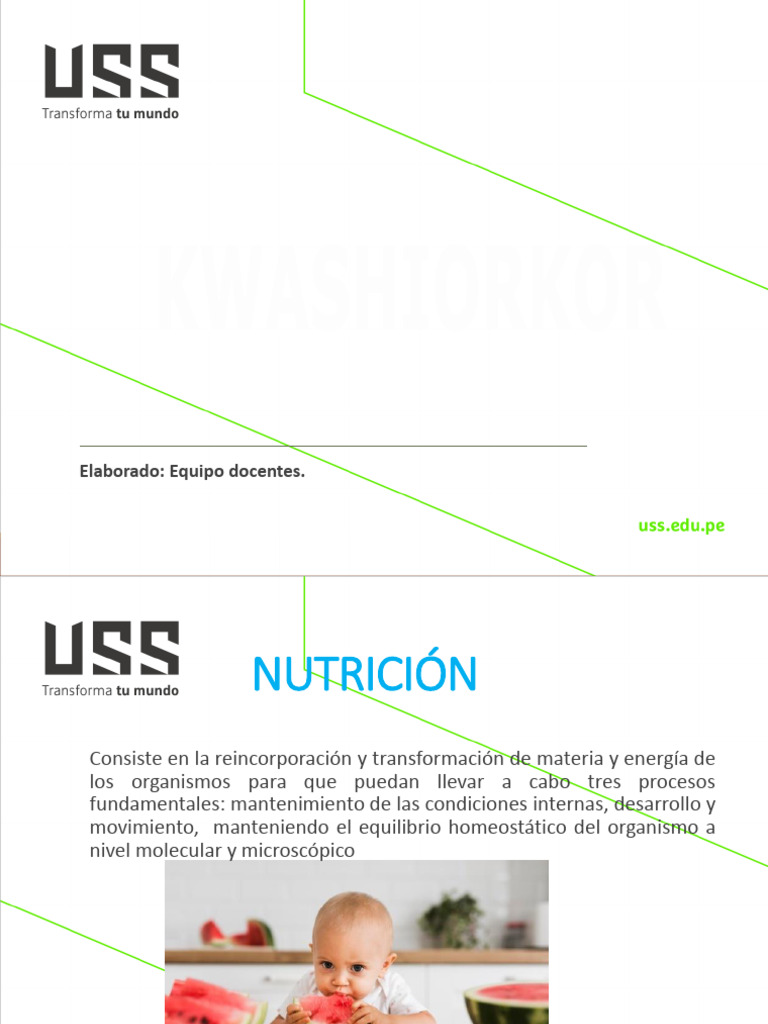 Desnutricion Infantil - Marasmo | PDF