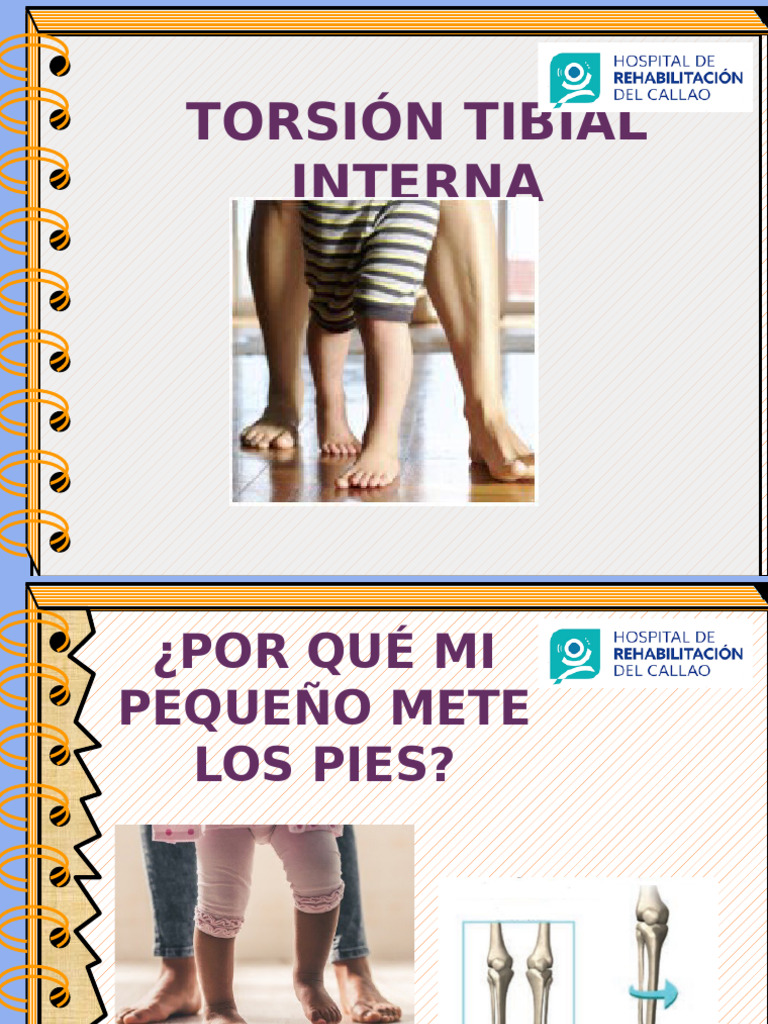 Torsion Tibial Interna | PDF