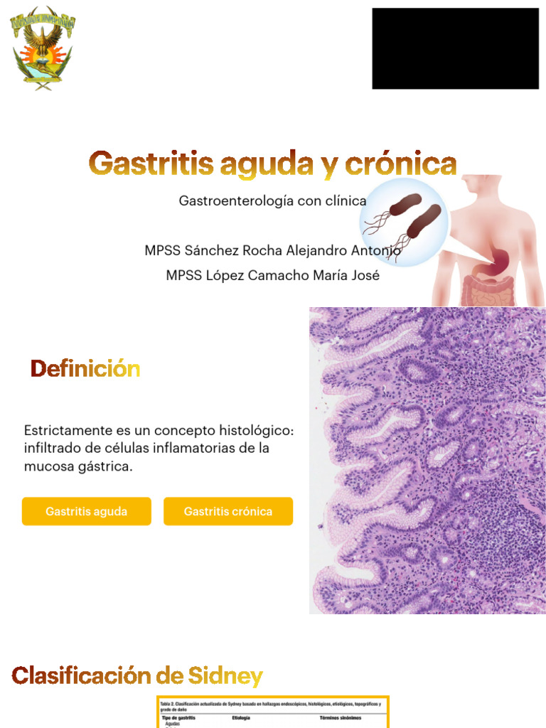 Gastritis | PDF