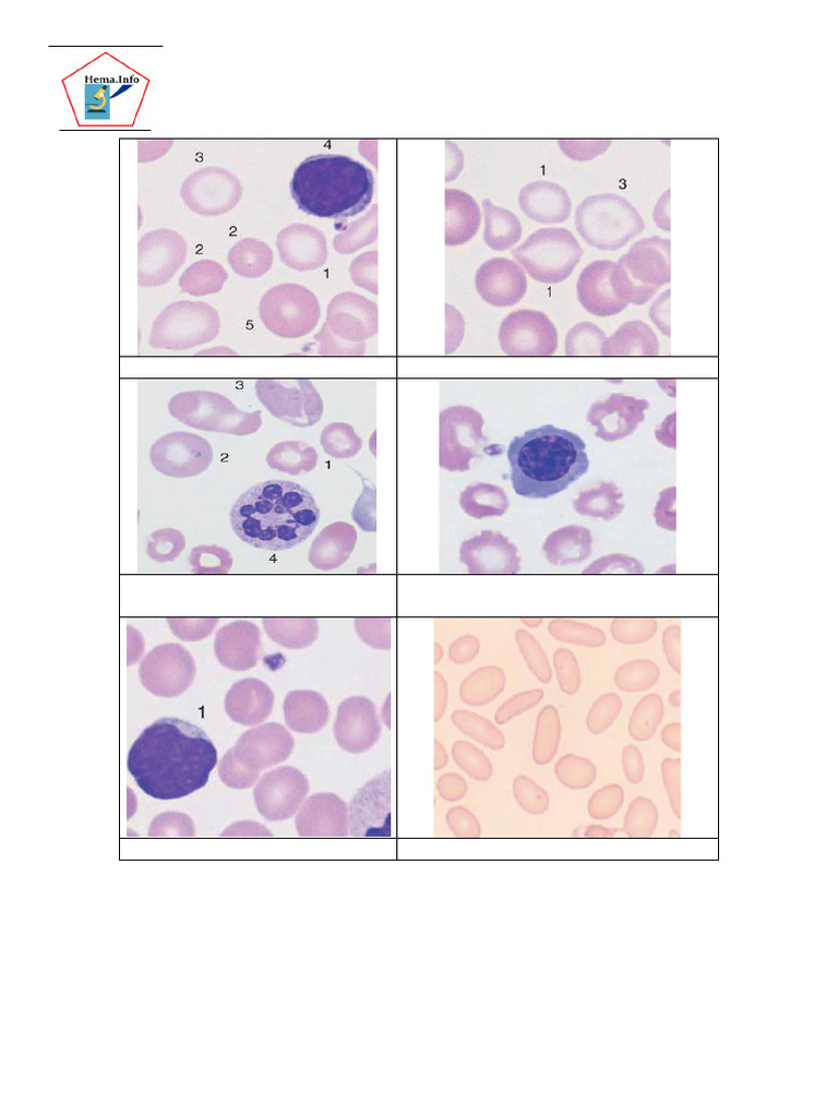 Mini Atlas RBC 1 | PDF