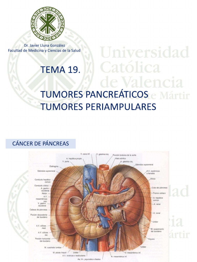 TEMA 19. CANCER PANCREAS | PDF