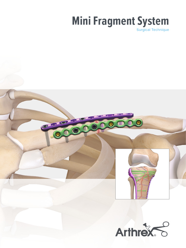 Caja Mini Fragmentos 2.0 Syntes Técnica Quirurgica | PDF