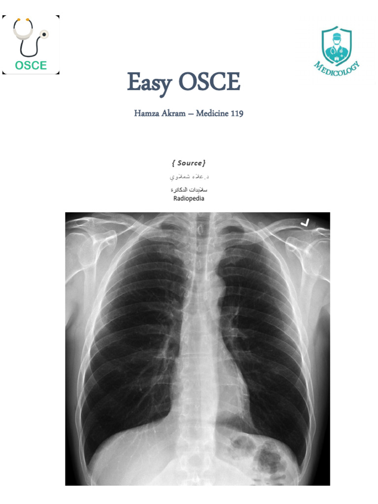 Easy OSCE: Chest X-Ray | PDF