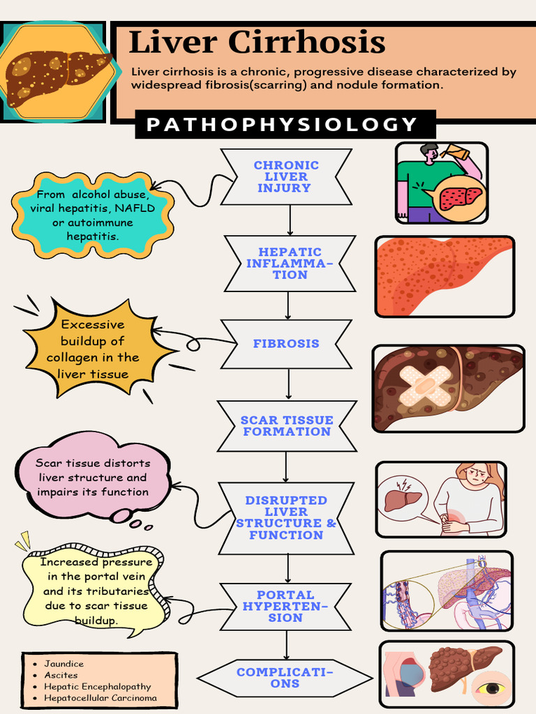 Liver Cirrhosis 2 | PDF