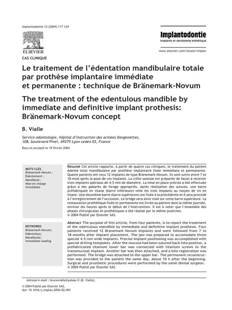 Prothese Imediade Implantaire Et Permanante | PDF