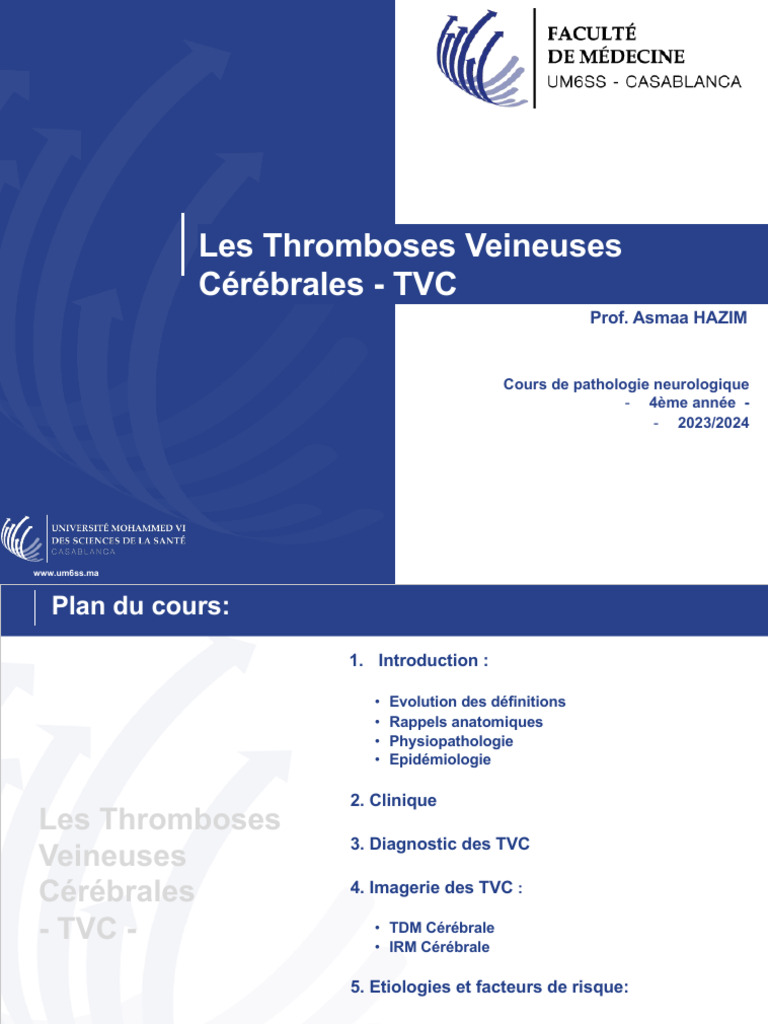 Présentation Tvc Pdf