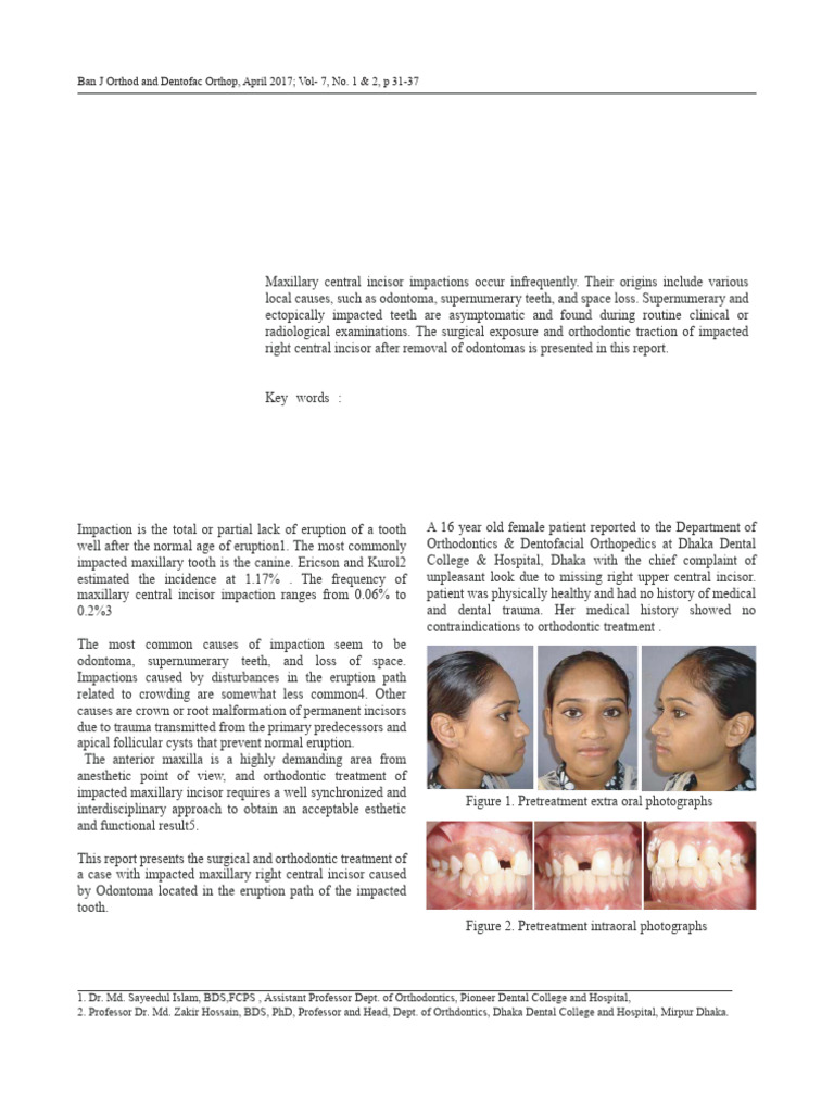 Impacted maxillary central incisors surgical exposure and orthodontic ...