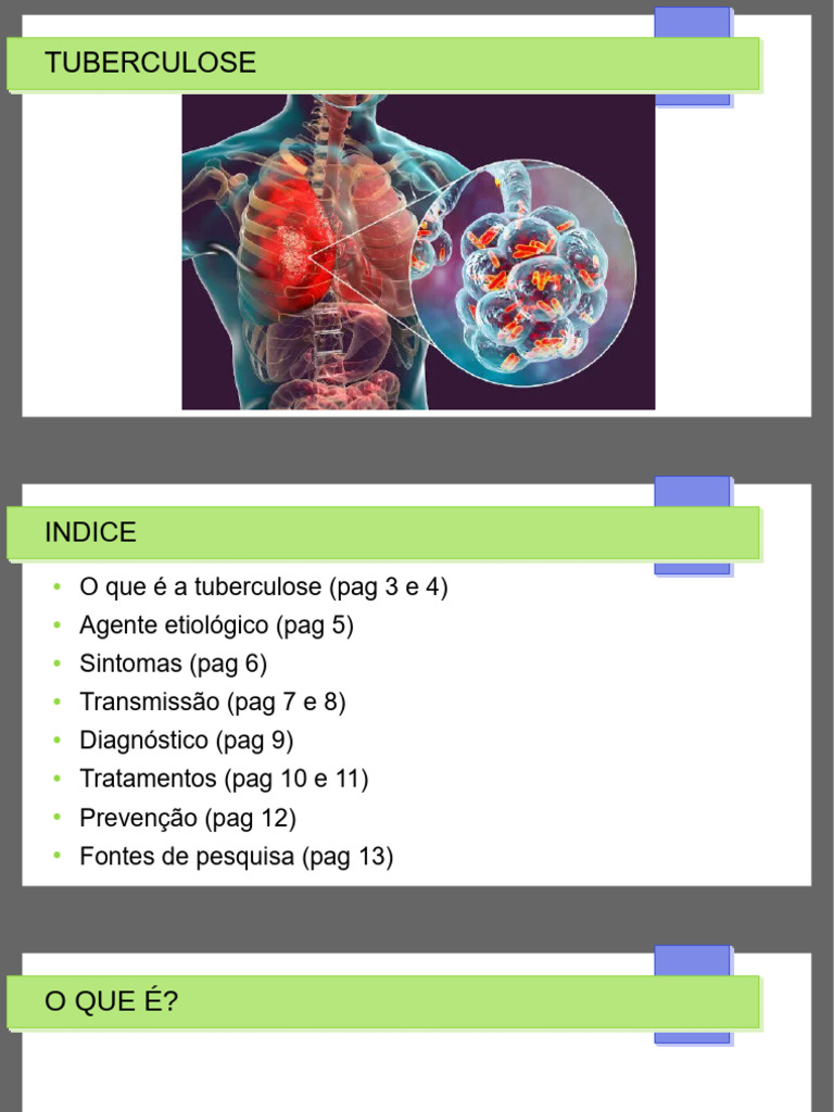 Tuberculose - Apresentação | PDF
