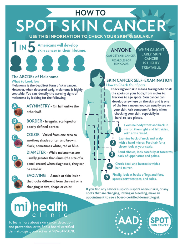How To Spot Skin Cancer | PDF | Skin Cancer | Melanoma