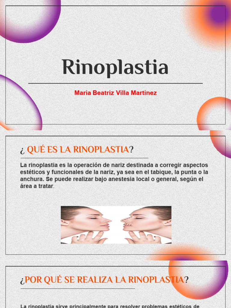 RINO | PDF