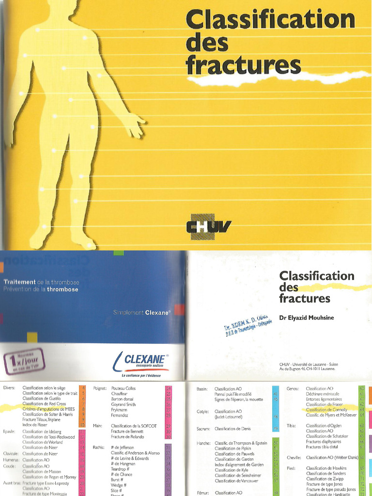 Classification Des Fractures - Doc Sanofi | PDF
