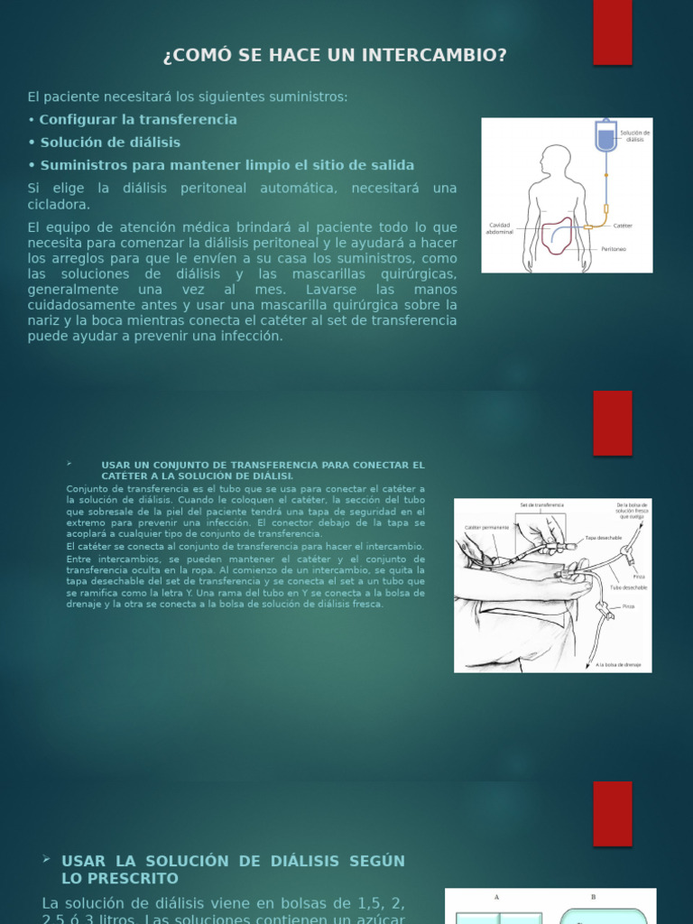 Comó Se Hace Un Intercambio | PDF