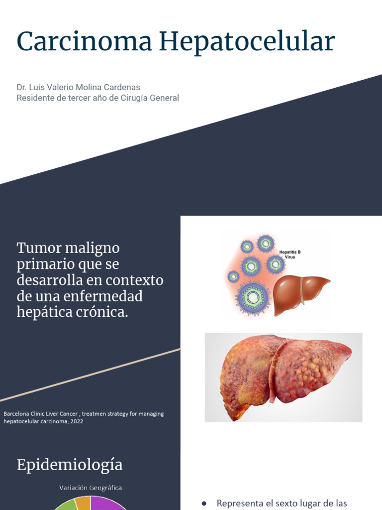 Carcinoma Hepatocelular | PDF | Cáncer | Ciencias de la Salud