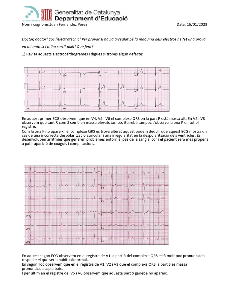 Activitat 10 (Extra) - Ecg | PDF