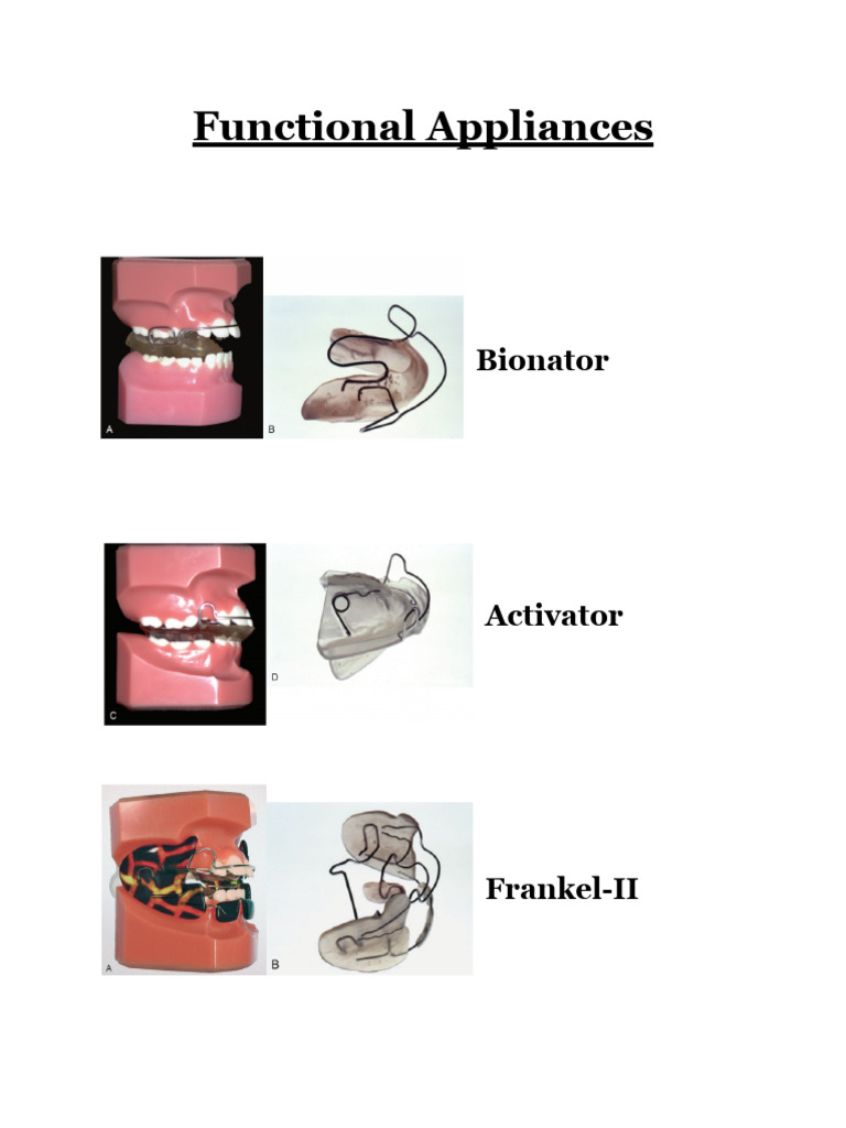 Functional Appliances-1 | PDF