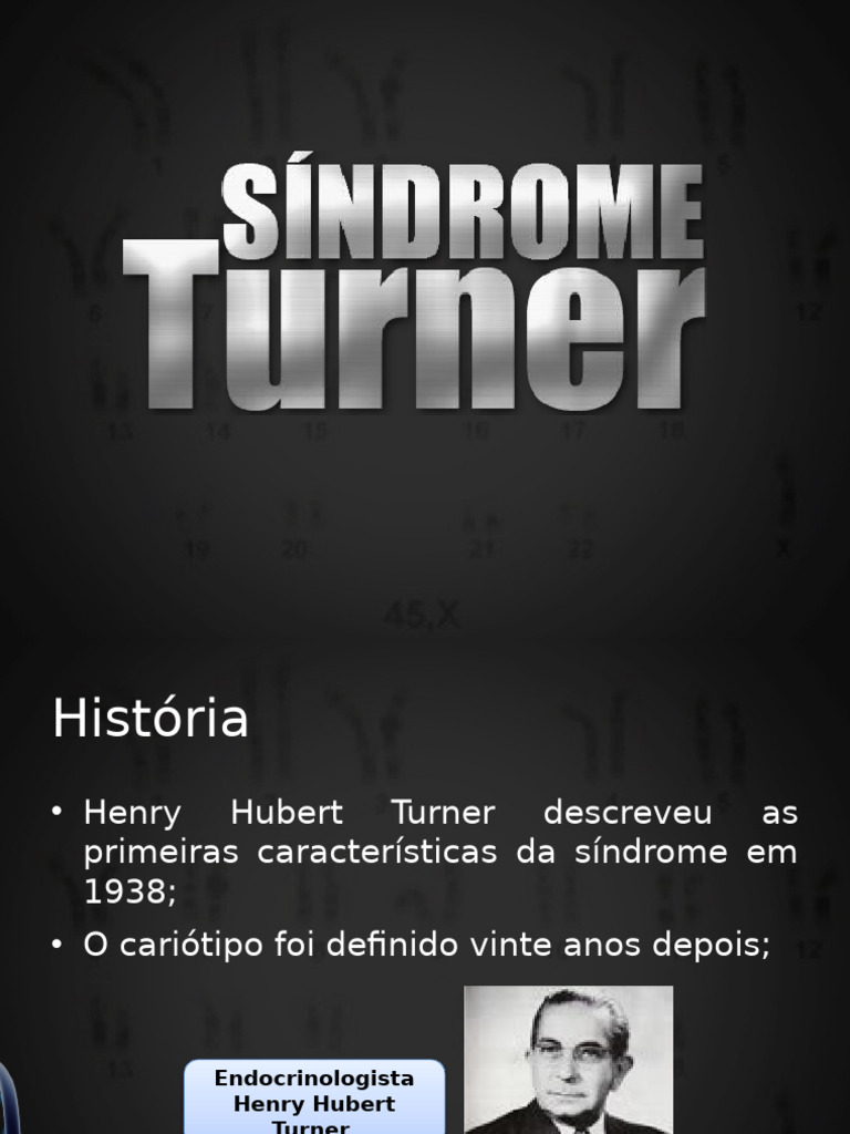 Slide Sindrome de Turner | PDF