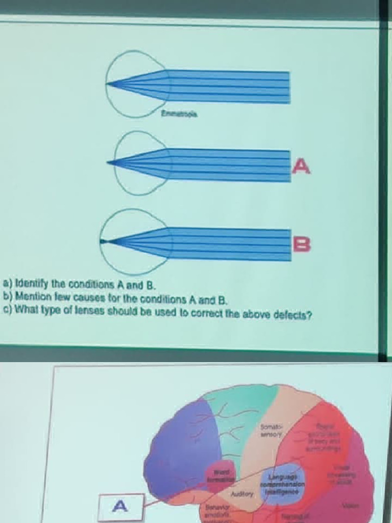 CNS-special senses charts | PDF