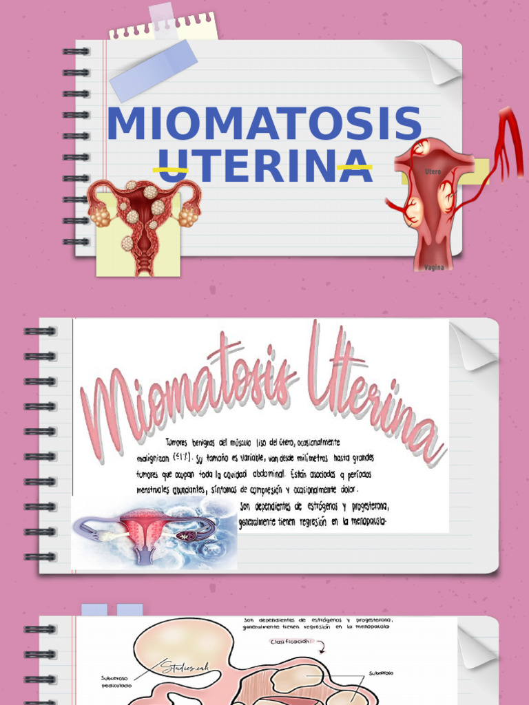 MIOMATOSIS | PDF