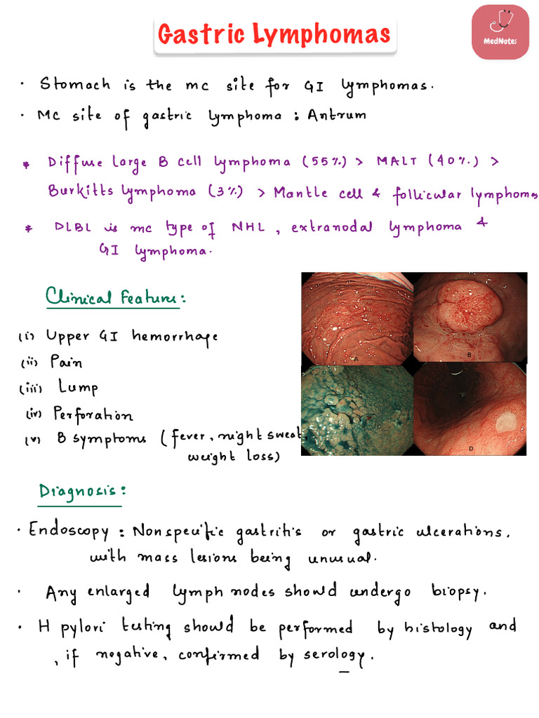 Gastric Lymphomas | PDF