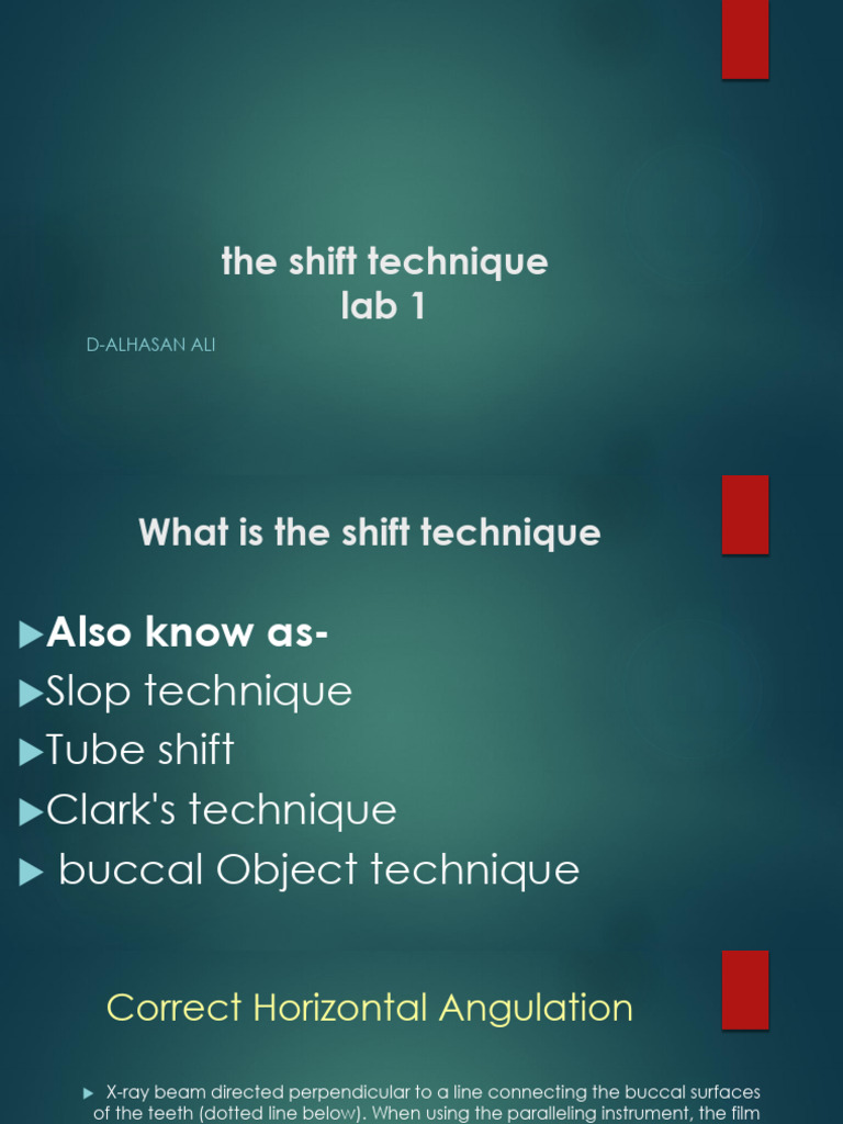 The Shift Technique Lab 1 | PDF